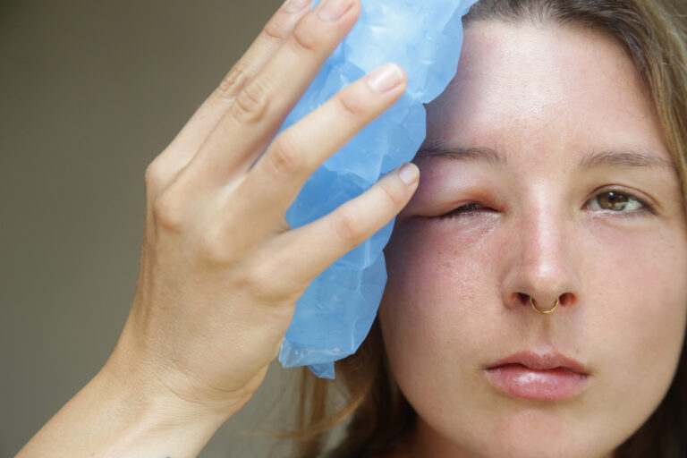 “Cortisol Face” Is Trending: Signs Your Stress Levels Are Actually ...