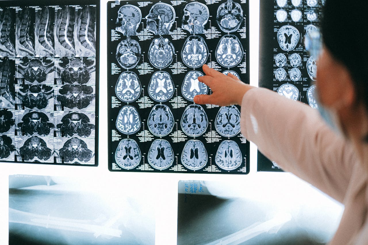 7 Medical Tests Now Requiring Pre-Authorization in Early-Year Policies ...