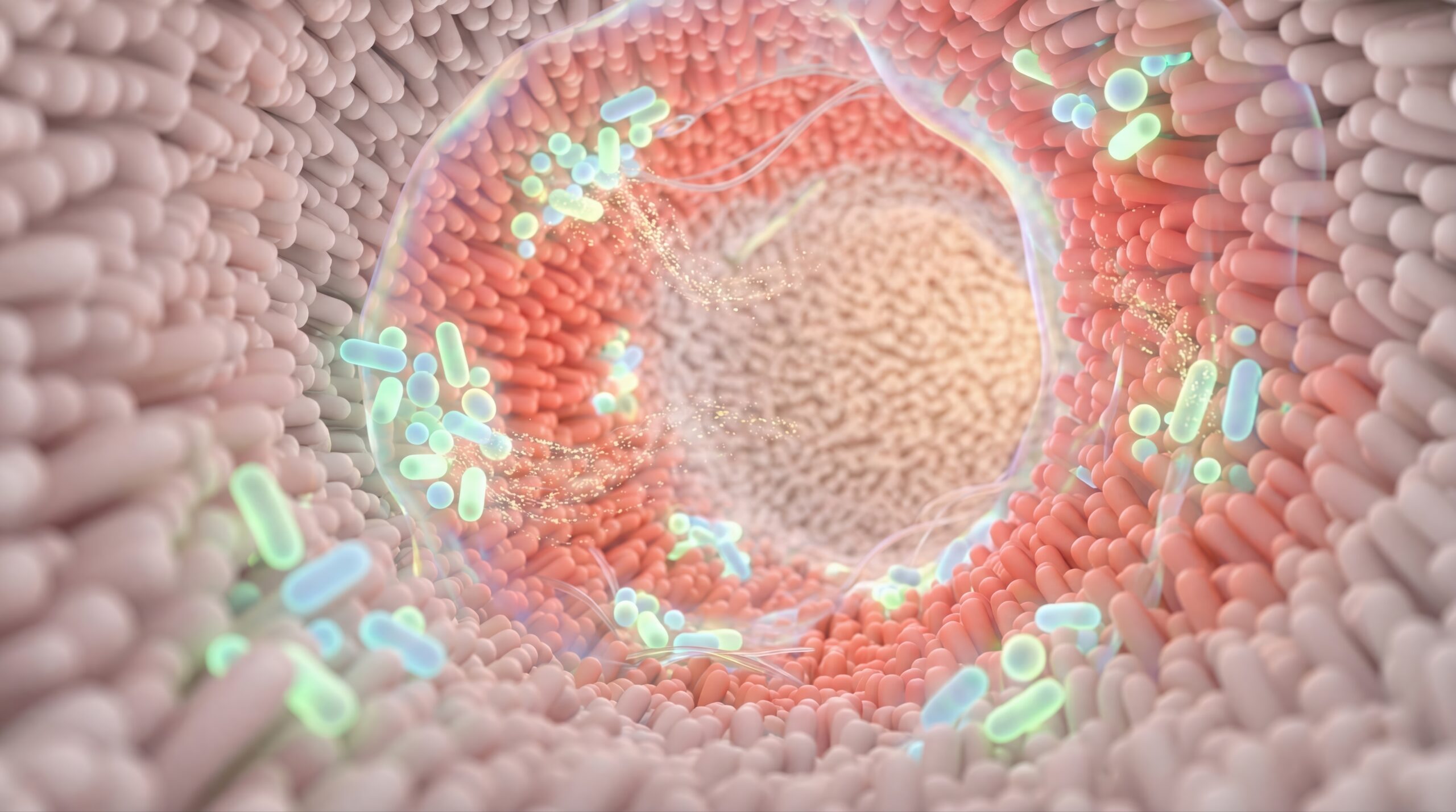 Gut Bacteria and Colon Cancer: Researchers Detail Prevention Strategies ...